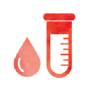 Before taking AVONEX